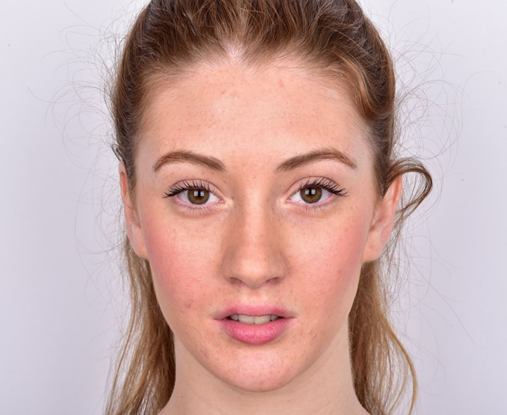 DSD Photo Protocol - Smile Art Lab